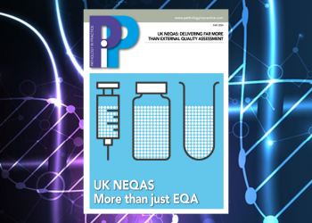 UK NEQAS Features in the May Edition of Pathology in Practice